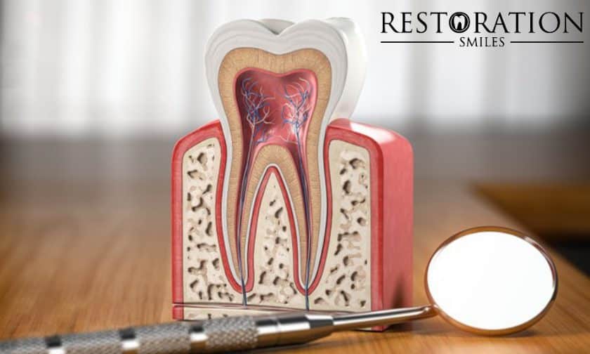 5 Things You Need To Know About Root Canals