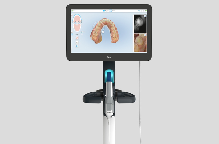 Itero 5d Scanner in Tomball TX | Restoration Smiles - Dentist Tomball